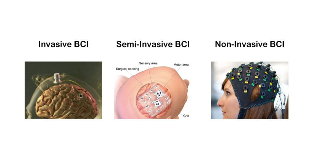 BCI คืออะไร เกี่ยวอะไรกับ Neuralink การรวมมนุษย์กับ AI - iT24Hrs